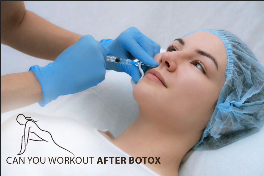 Flex or Rest? Can You Workout After Botox? - Sheru Classic world Flex or Rest? Can You Workout After Botox? - Sheru Classic world